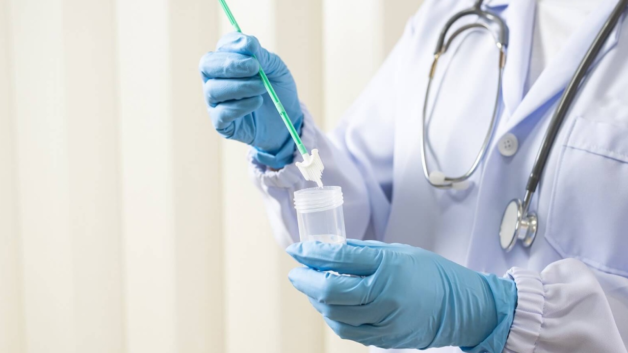 Tìm hiểu thinprep pap test là gì và những lưu ý